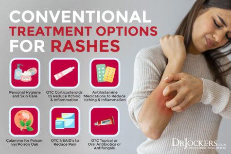 Skin Rashes: Symptoms, Causes and Natural Support Strategies