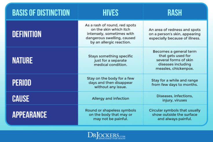 Skin Rashes: Symptoms, Causes and Natural Support Strategies