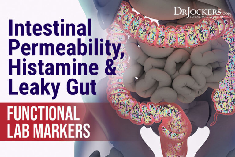 Intestinal Permeability, Histamine, and Leaky Gut Functional Lab Markers