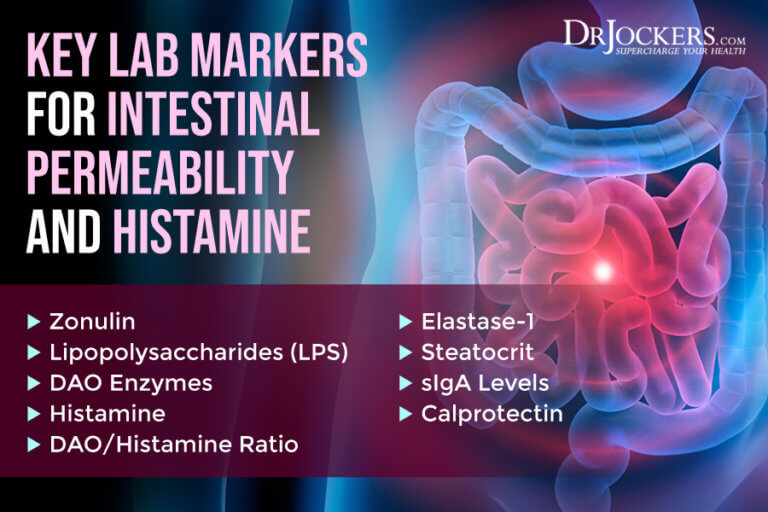 Intestinal Permeability, Histamine, and Leaky Gut Functional Lab Markers