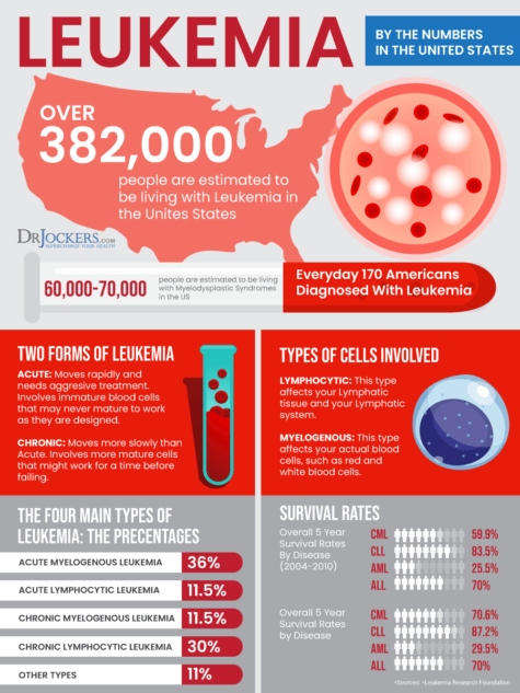 Leukemia: Symptoms, Causes, and Support Strategies - DrJockers.com