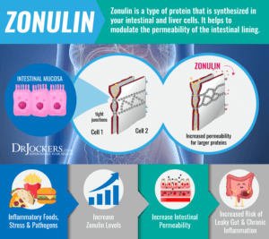 Intestinal Permeability, Histamine, and Leaky Gut Functional Lab Markers