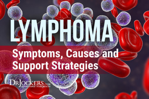 Lymphoma: Symptoms, Causes, and Support Strategies - DrJockers.com