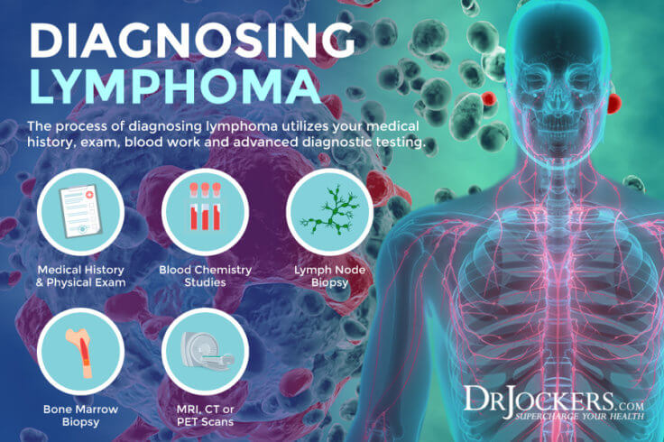 Lymphoma: Symptoms, Causes, and Support Strategies - DrJockers.com