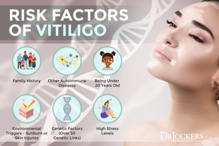 Vitiligo: Symptoms, Causes, and Support Strategies