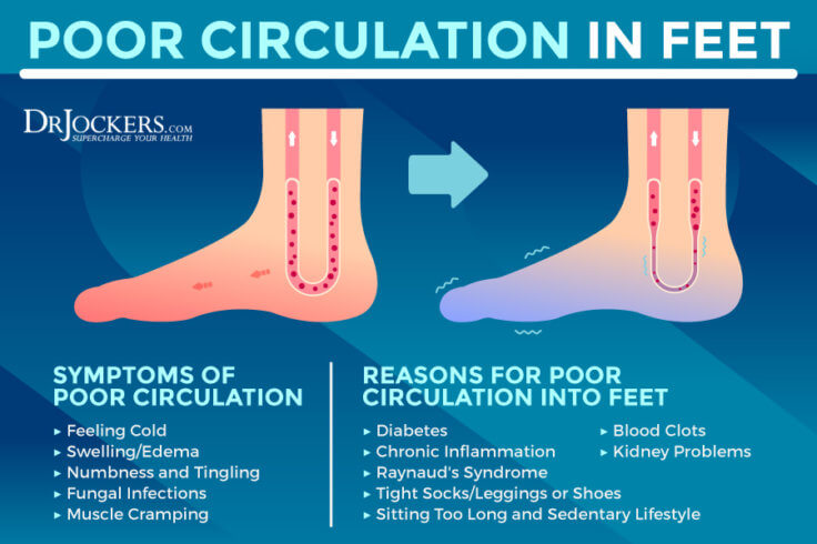 Toenail Fungus: Symptoms, Causes and Support Strategies