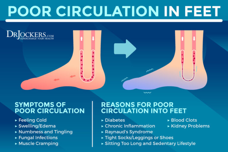 Toenail Fungus: Symptoms, Causes and Support Strategies