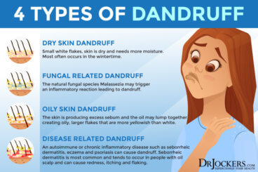 Dandruff: Root Causes and Support Strategies - DrJockers.com