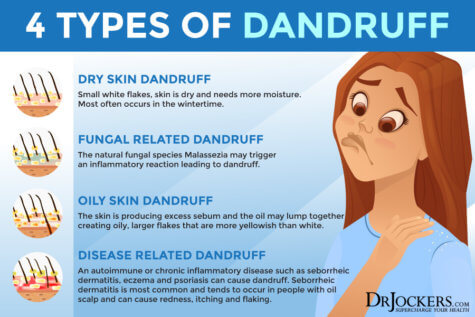 Dandruff: Root Causes and Support Strategies - DrJockers.com