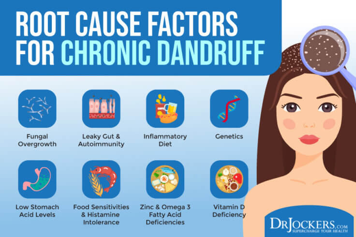 Dandruff: Root Causes and Support Strategies - DrJockers.com