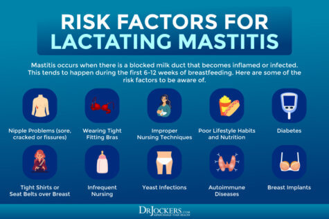 Mastitis During Breastfeeding: Symptoms and Support Strategies