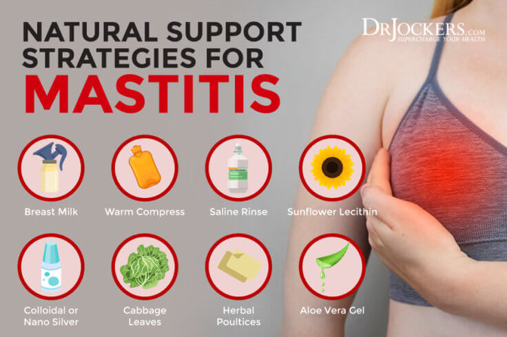 Mastitis During Breastfeeding: Symptoms and Support Strategies