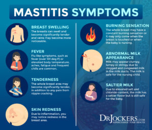 Mastitis During Breastfeeding: Symptoms and Support Strategies
