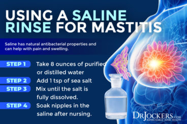 Mastitis During Breastfeeding: Symptoms and Support Strategies