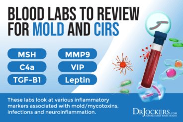Mold and CIRS Markers - DrJockers.com