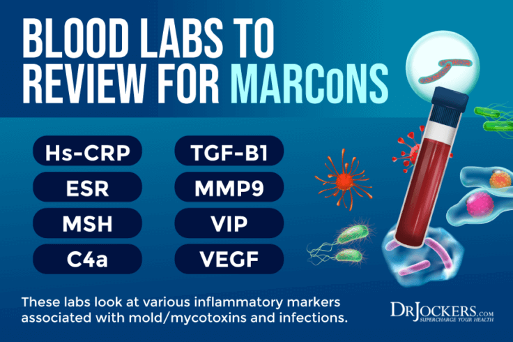 MARCoNS: Symptoms, Causes, and Support Strategies