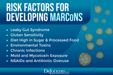 MARCoNS: Symptoms, Causes, and Support Strategies