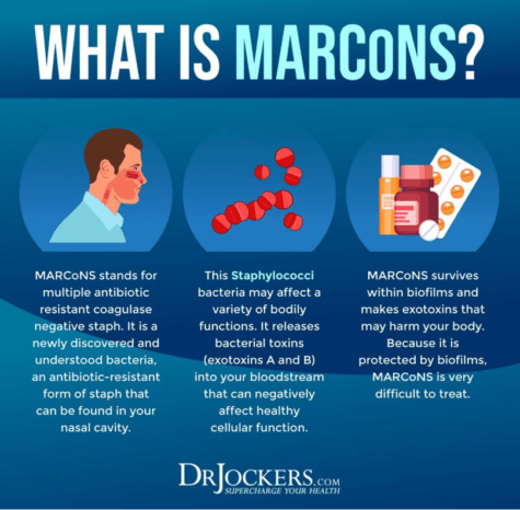 MARCoNS Testing - DrJockers.com