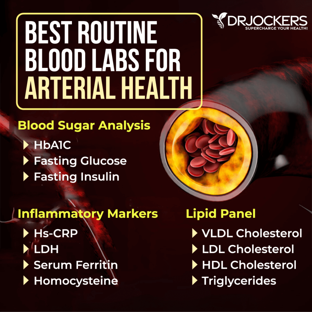 High Triglycerides: Root Causes and Natural Support Strategies