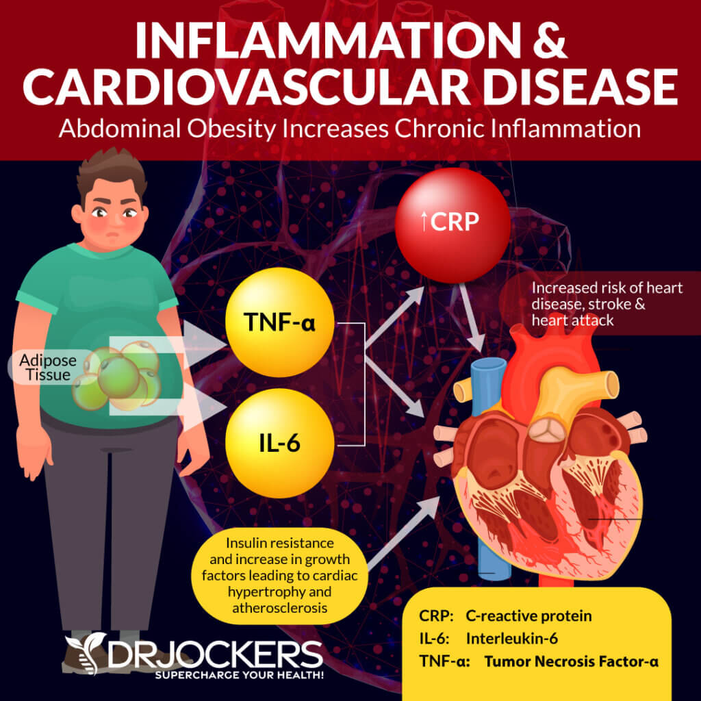 Clogged Arteries: Causes, Symptoms & Support Strategies