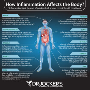 5 Ways To Reduce Inflammation Quickly - DrJockers.com
