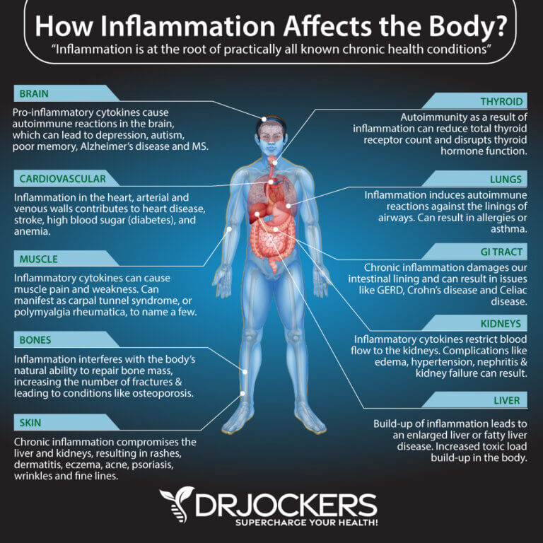 5 Ways To Reduce Inflammation Quickly - DrJockers.com