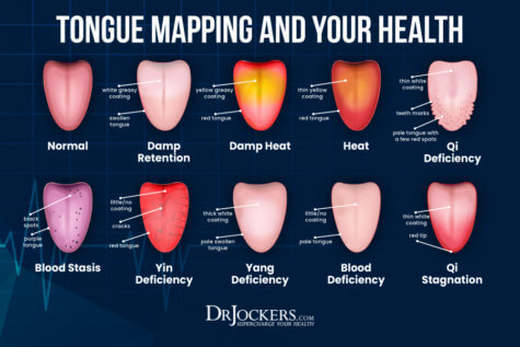 Tongue Mapping To Discover Hidden Health Problems
