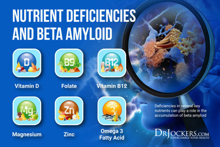 Beta Amyloid: Link to Alzheimer's and Healing Strategies