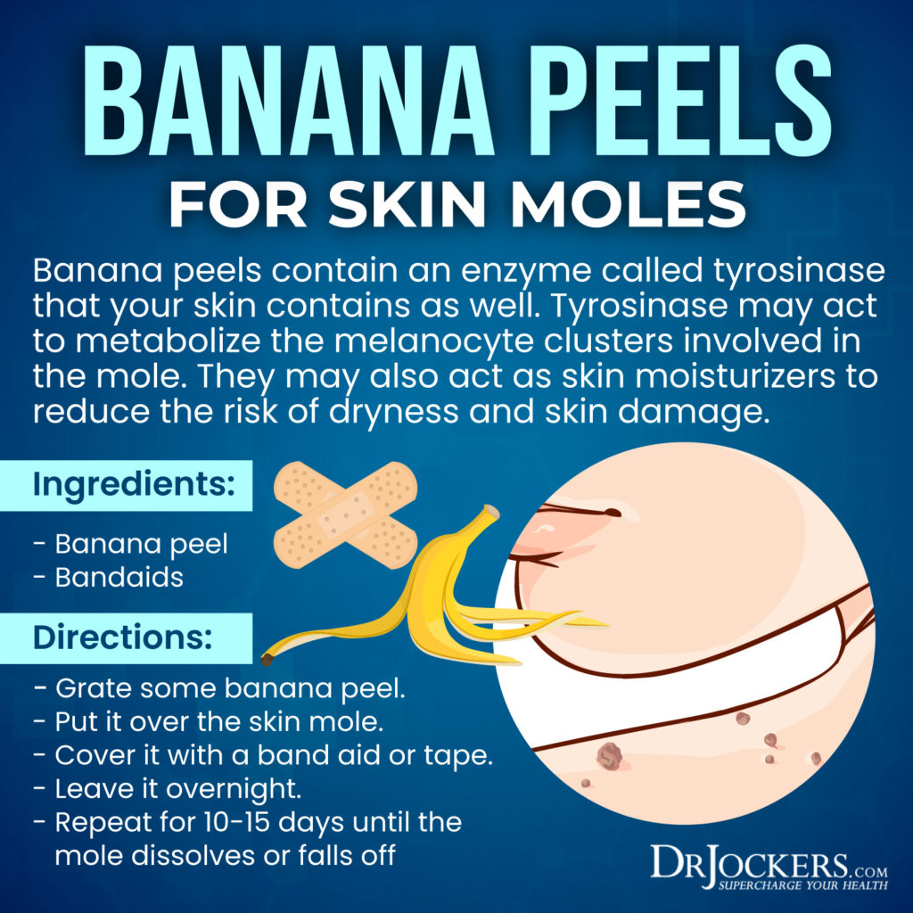 Skin Moles: Signs of Cancer and 10 Natural Removal Strategies