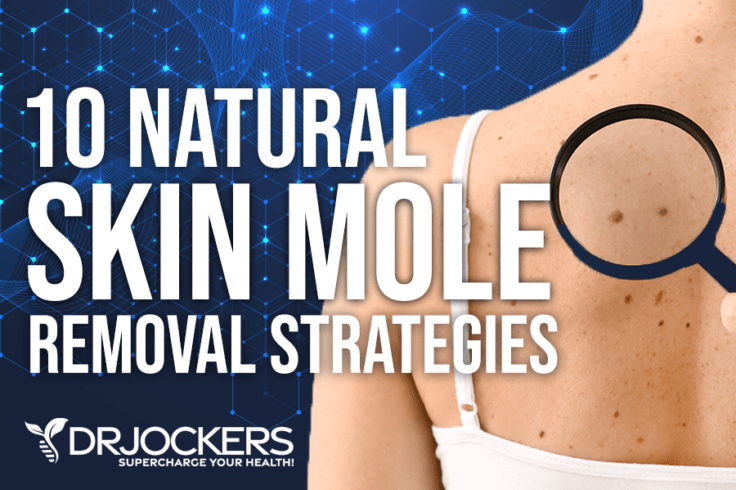 Skin Moles: Signs of Cancer and 10 Natural Removal Strategies