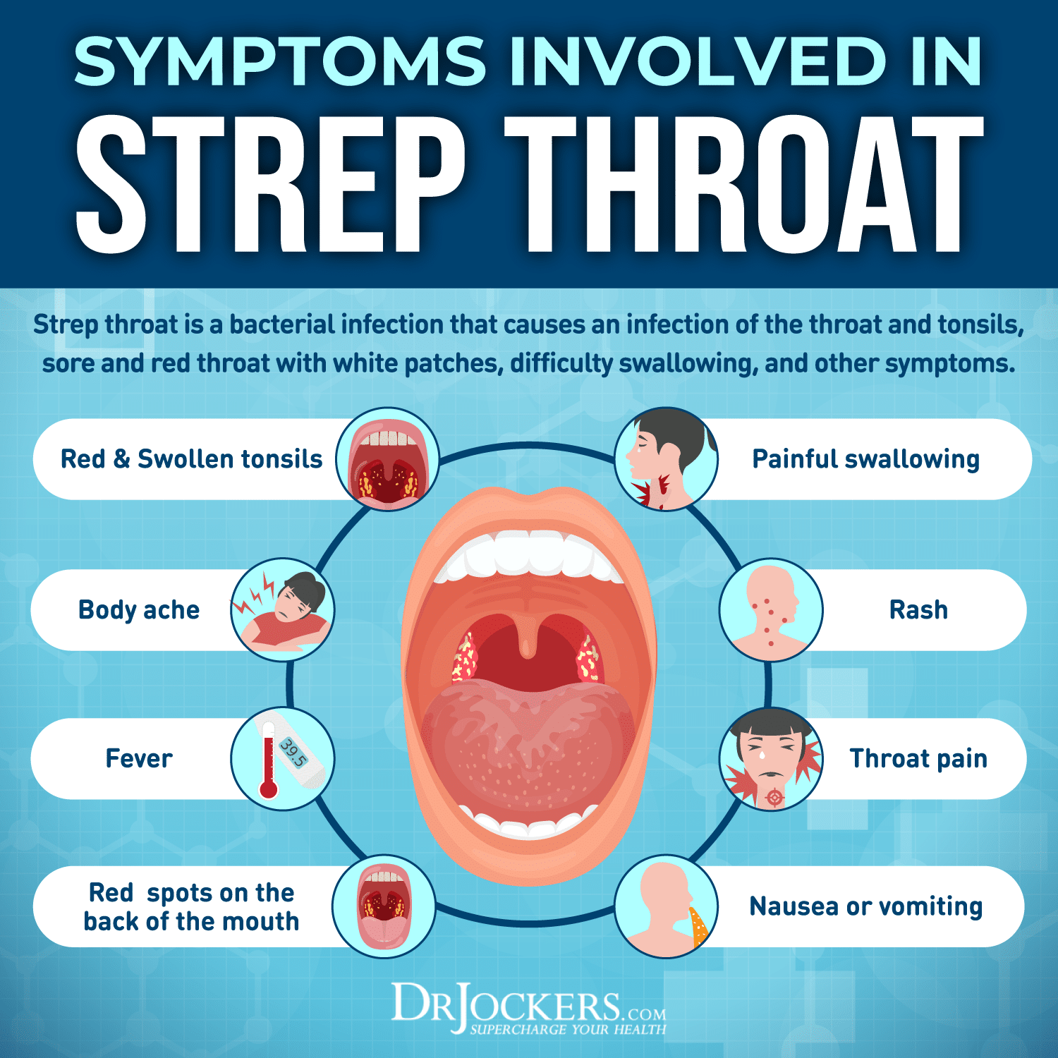 Bacterial Tonsil Infection