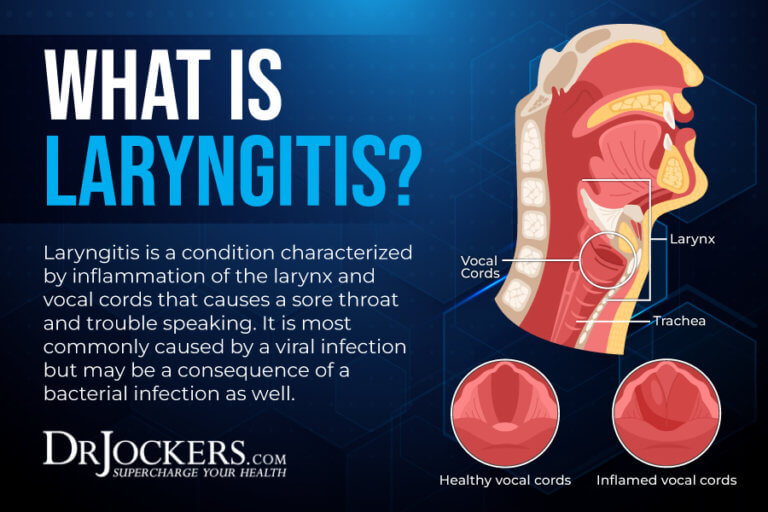 Laryngitis: Symptoms and Natural Support Strategies
