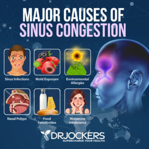 Sinus Congestion: Causes, Symptoms & Support Strategies