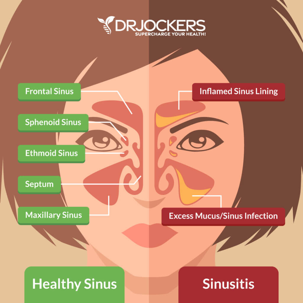 Sinus Infections: Causes, Symptoms & Natural Support Strategies