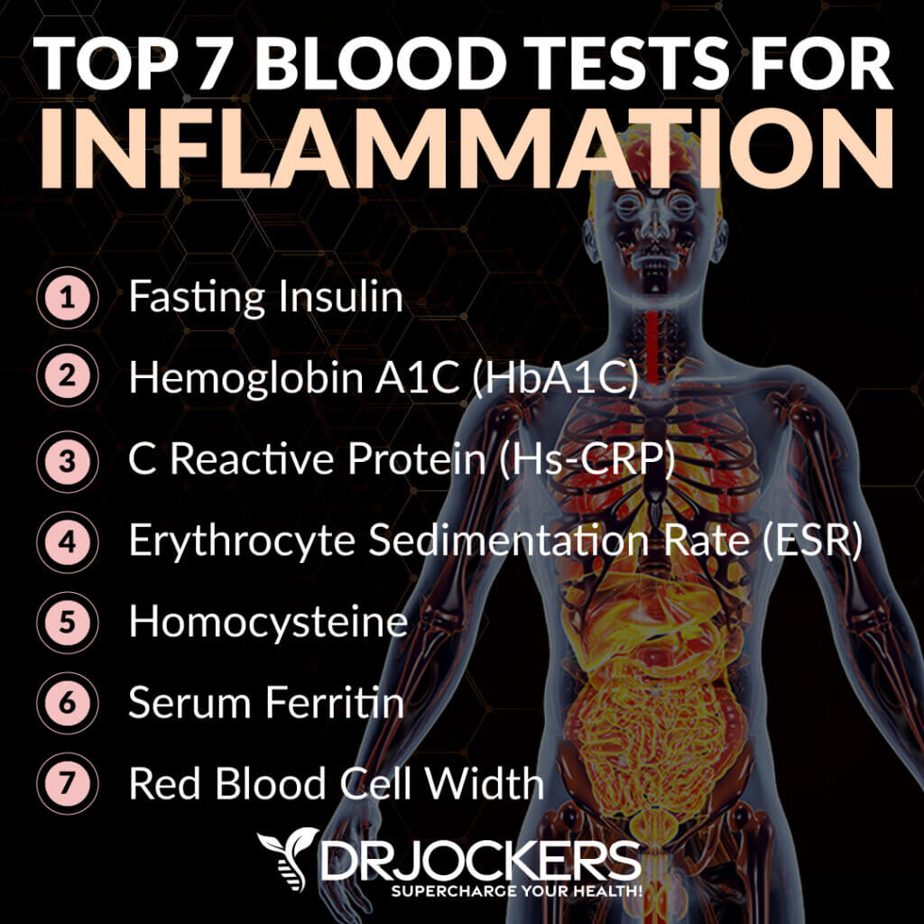 GlycA: A New Biomarker for Systemic Inflammation - DrJockers.com