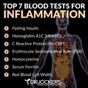 Inflammaging: The Role of Inflammation in Aging