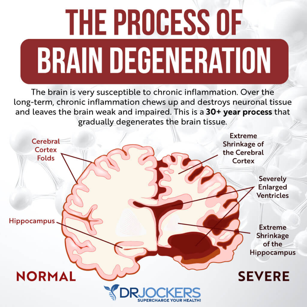 Brain Autophagy: Healing the Toxic Brain - DrJockers.com