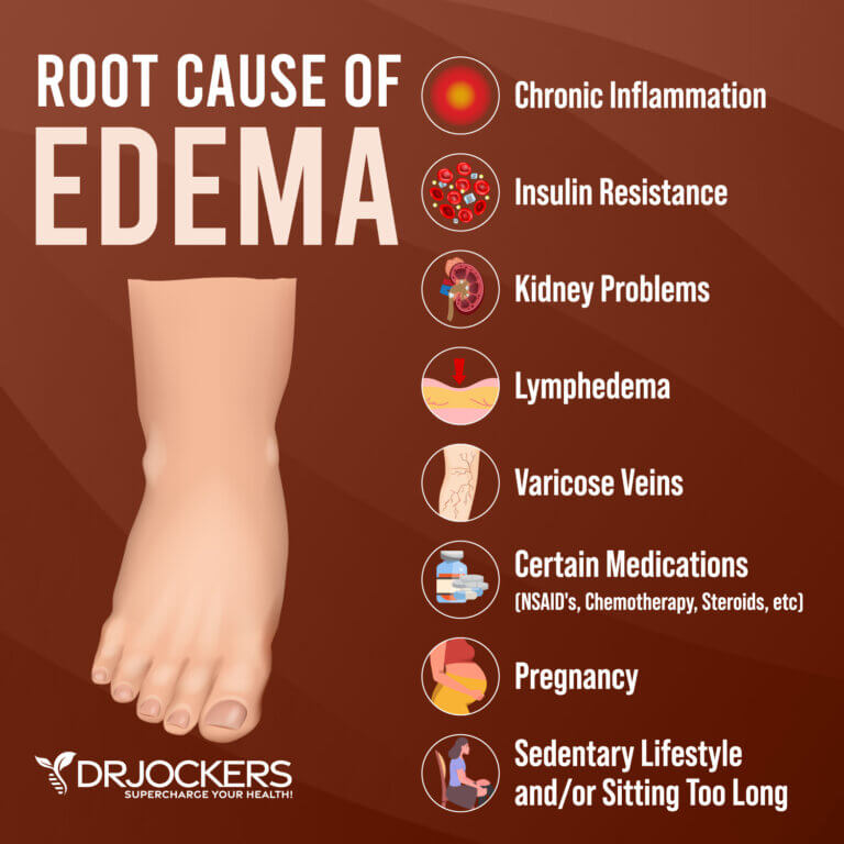 Edema: Symptoms, Causes, and Natural Support Strategies