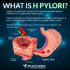 The Damaging Effects of H Pylori Infections - DrJockers.com