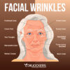 Facial Wrinkles: Root Causes and Natural Support Strategies