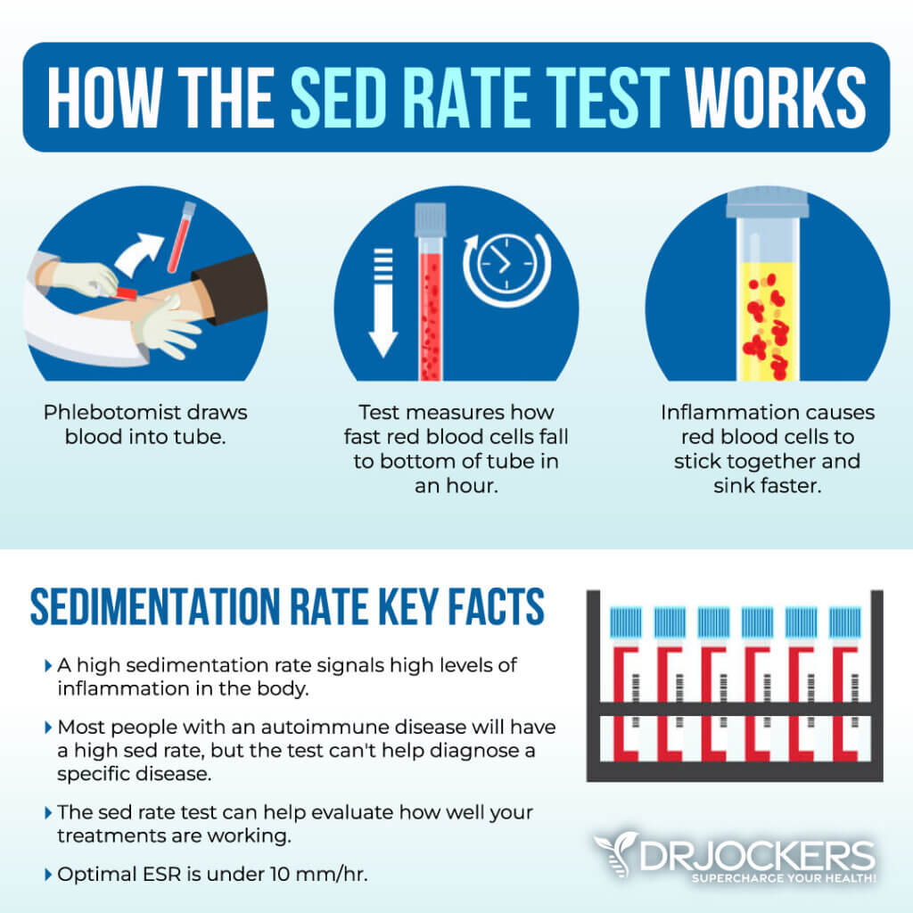 Top 12 Inflammatory Lab Markers and Optimal Ranges