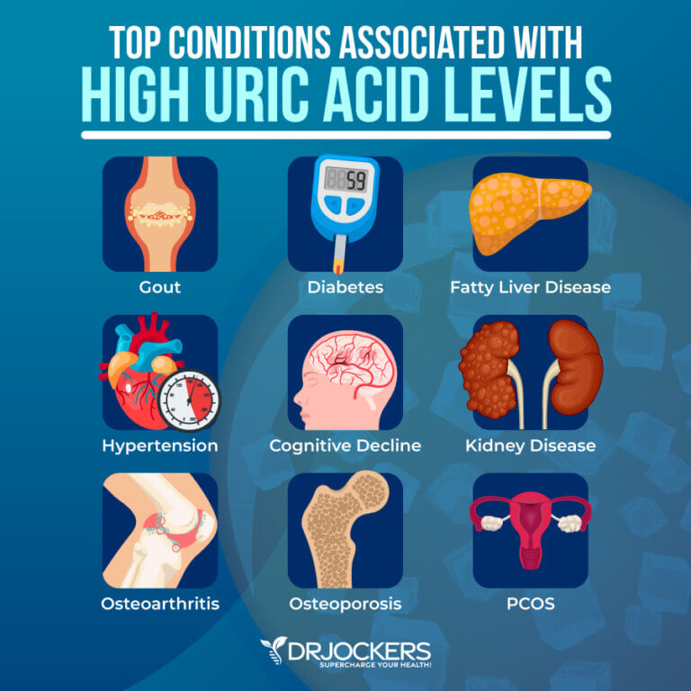 Uric Acid: A Key Player in Cardio, Brain, and Metabolic Diseases