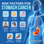 H Pylori Protocol: Diet & Herbal Strategies - DrJockers.com