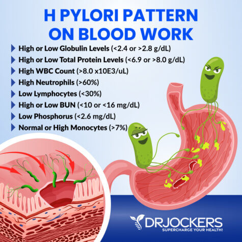 H Pylori Protocol: Diet & Herbal Strategies - DrJockers.com