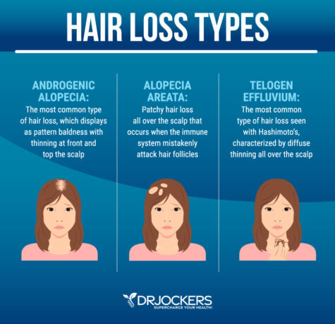 Female Hair Loss: Causes and Natural Support Strategies - DrJockers.com