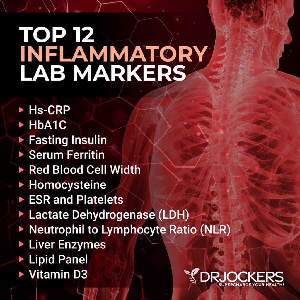 Top 12 Inflammatory Lab Markers and Optimal Ranges