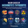 Hashimoto's Thyroiditis: Causes, Symptoms and Support Strategies