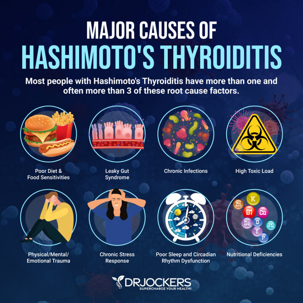 Hashimoto's Thyroiditis: Causes, Symptoms and Support Strategies